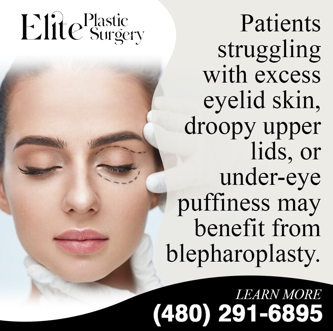 Blepharoplasty Vs. Brow Lift Surgery