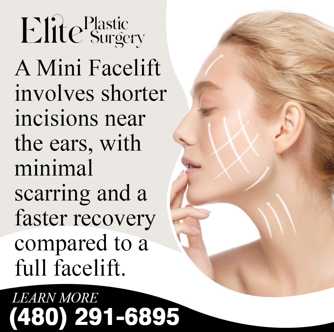 Mini Facelift vs. Full Facelift: Choosing the Best Option