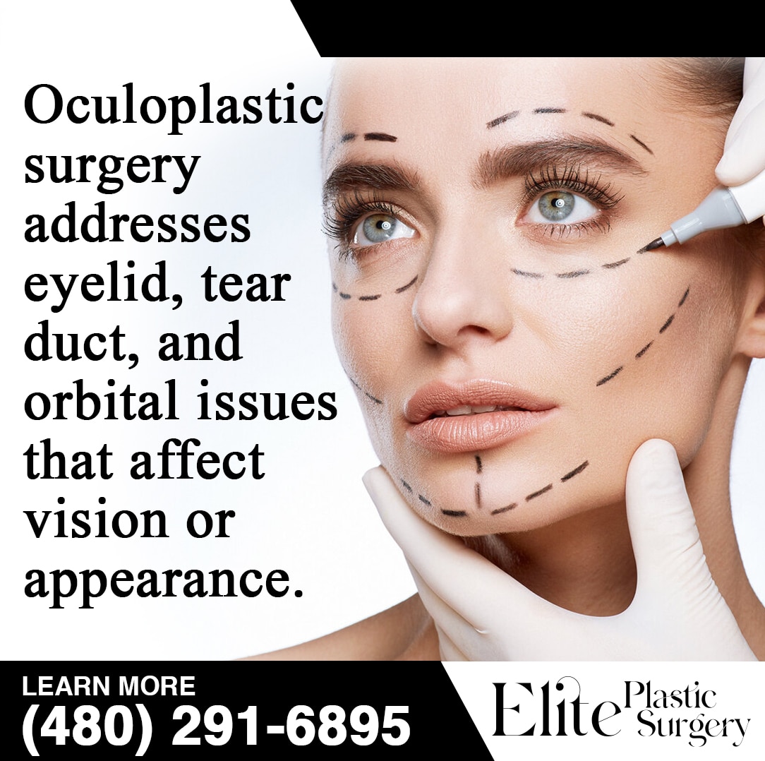 Types Of Oculoplastic Surgery - Elite Plastic Surgery